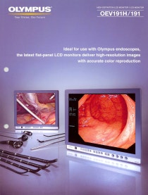 Endoscope System, Video ENT (Stryke / Xion / Olympus) : 네이버 블로그