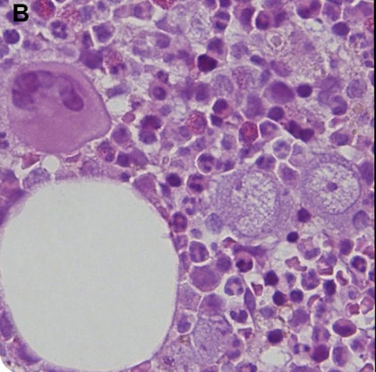 망상발진 제5병