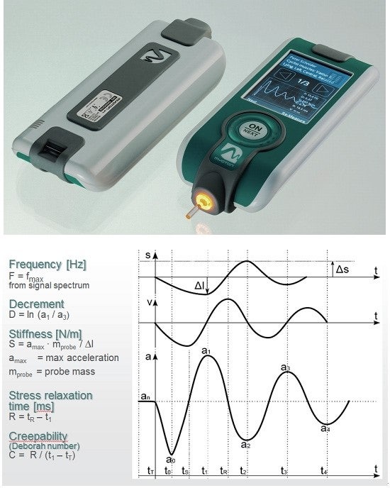 접촉식 근긴장도 측정시스템 Myoton PRO : 네이버 블로그