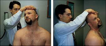 척추사이 구멍 압박 / 스펄링 검사(추간공압박검사) _ foraminal compression/spurling test ...