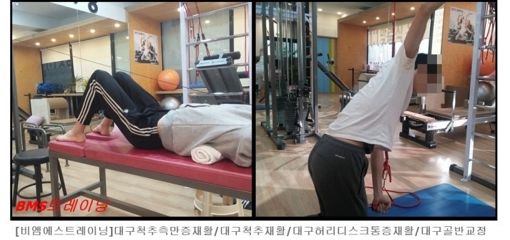 대구척추측만증재활대구척추재활대구허리디스크통증재활대구골반교정 허리통증과 척추측만증 증상과 재활운동 네이버 블로그