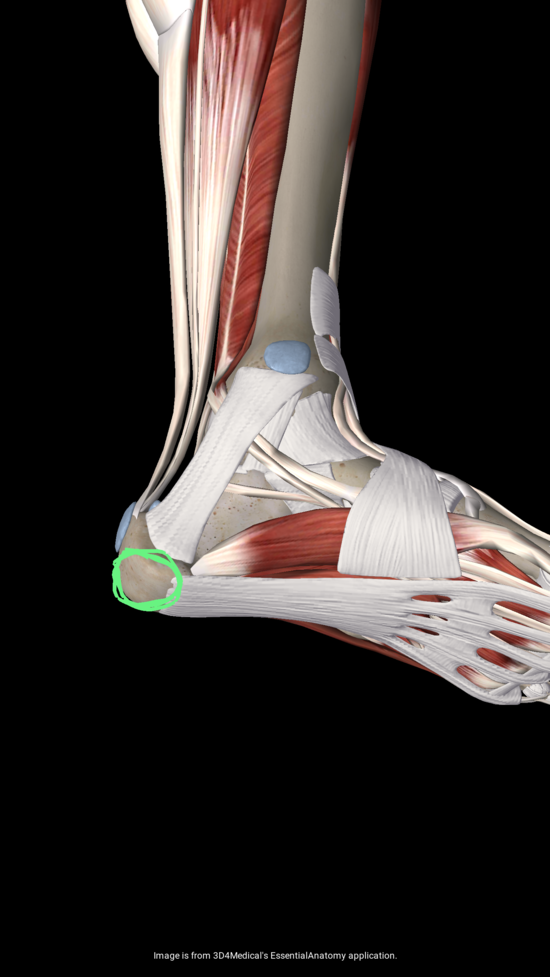 뒤꿈치 통증 : 뒤꿈치패드 증후군(Heel fat pad syndrome) : 네이버 블로그