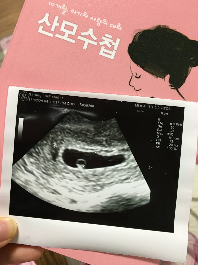 임신 6주차 증상 난황 심장소리 And 산모수첩 네이버 블로그