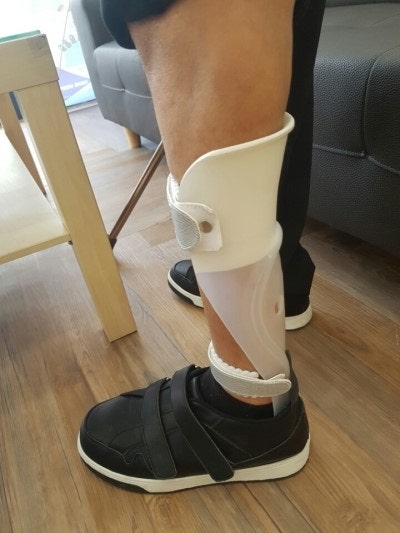 Posterior leaf spring AFO ( PLS AFO, PLSO ) 발끌림, 플라스틱 맞춤형 발목 관절 보조기, 발목 ...
