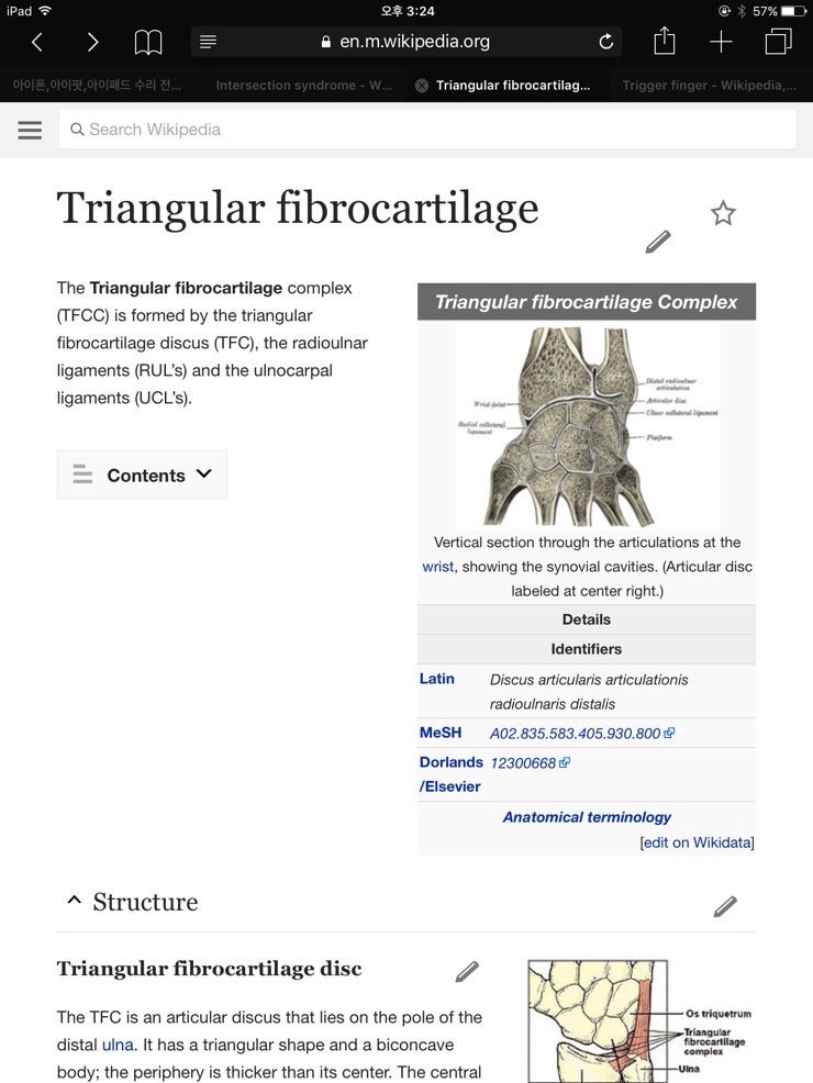 Triangular fibrocartilage complex : 네이버 블로그