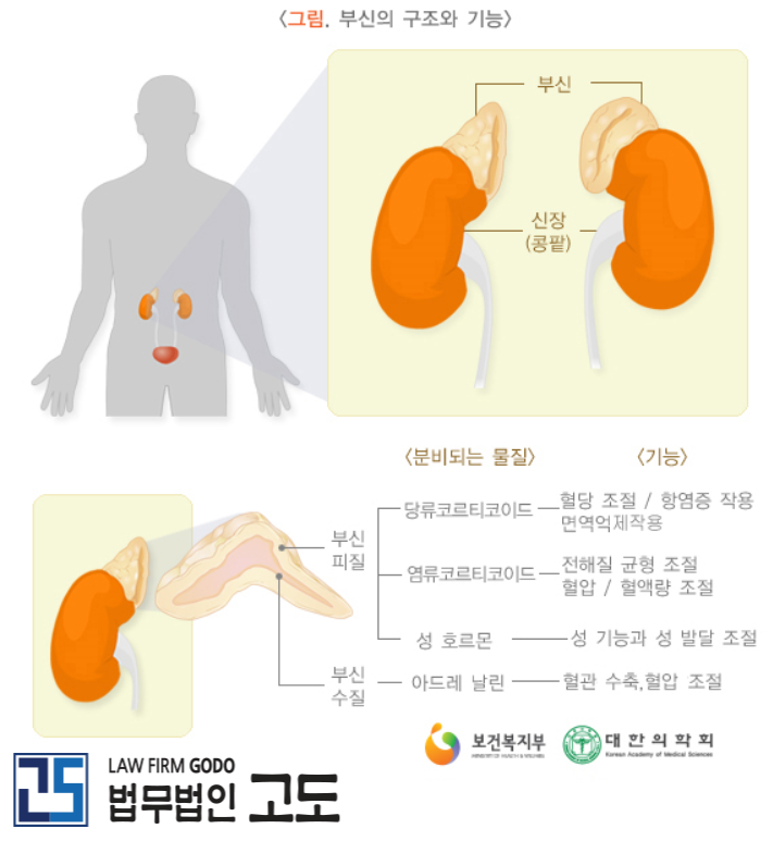 부신질환1 쿠싱증후군 의료사고 이용환변호사 네이버 블로그