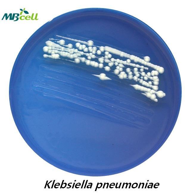 DNase Agar with Toluidine Blue MB-D2158 : 네이버 블로그