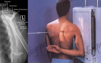 Shoulder X Ray Positions