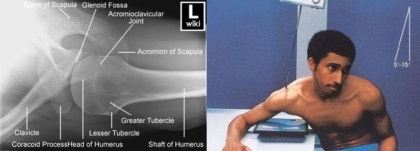 shoulder lateral view position