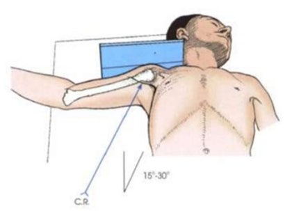 shoulder lateral view position