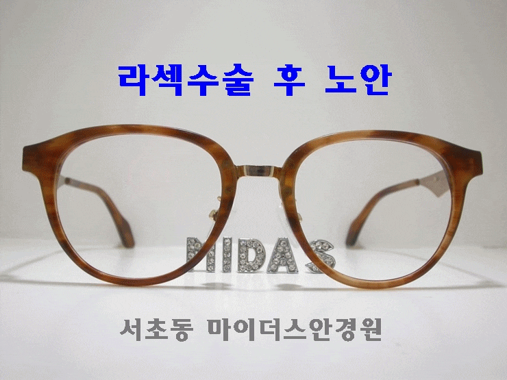 라섹수술 후 노안해결 결국은 누진다초점렌즈가 정답 입니다수술후안경 시력검사전문 마이더스안경원 ㄴㅈㅇㄴ 네이버 블로그