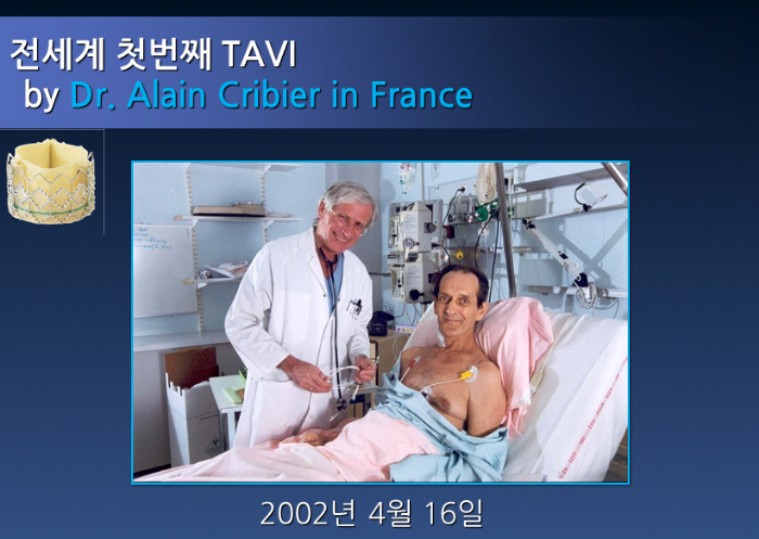 경피적 대동맥판막 치환술 (Transcatheteraorticvalve implantation, TAVI) 이란? -2 / 서울 ...