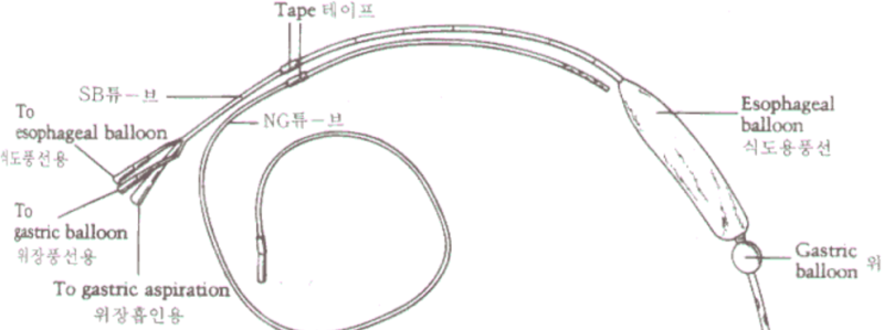 상스타켄 블레이크모어관 (SB tube, 풍선압박지혈법, Sengstaken-Blakemore tube, Balloon ...