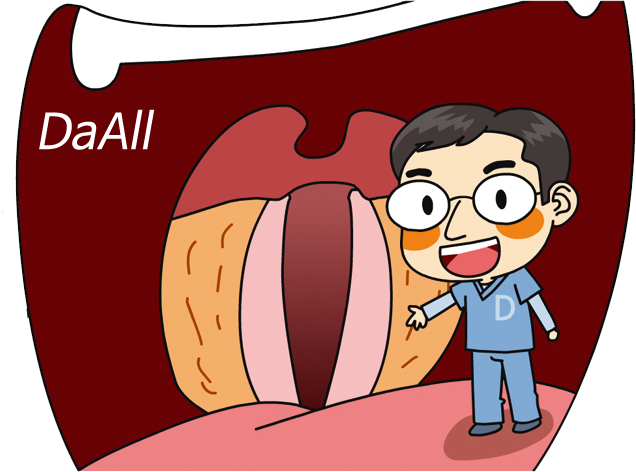 성대폴립 수술 후 빠른 회복 관리 네이버 블로그