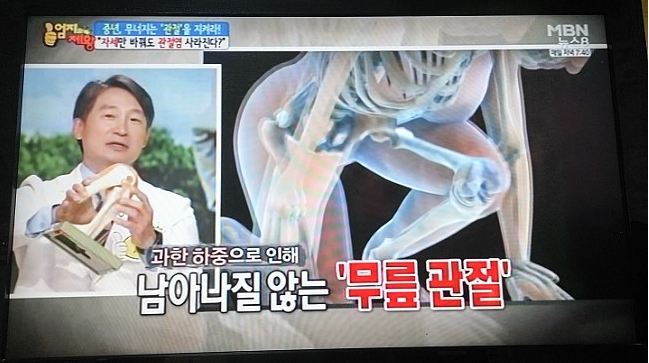 글루코사민 효능 효과 부작용 섭취량 관절 연골 건강에 도움을 주는 천연 아미노당 네이버 블로그