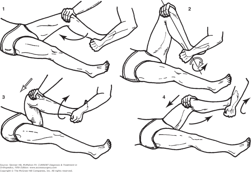 [Knee Special Test] McMurray's test : 네이버 블로그