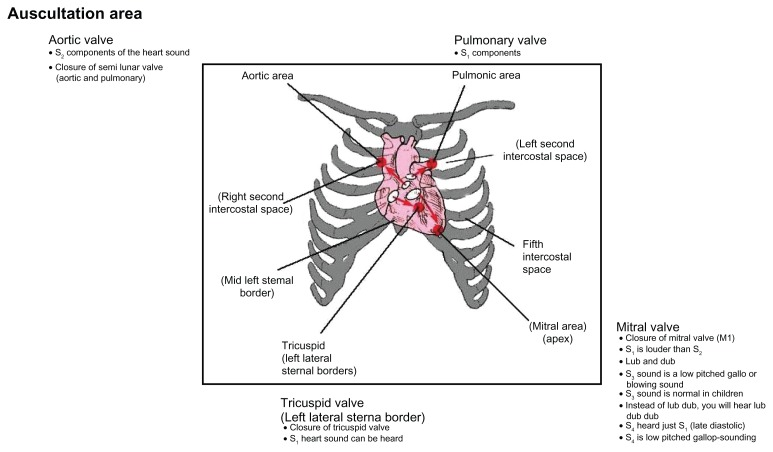 Stethoscope/Auscultation landmarks : 네이버 블로그