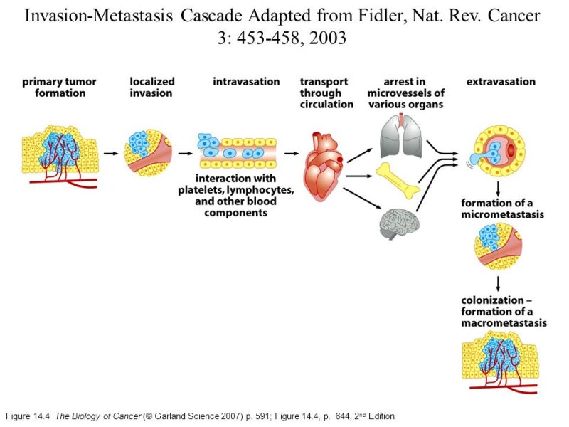 암은 어떻게 전이 되는가(metastasis cascade) : 네이버 블로그