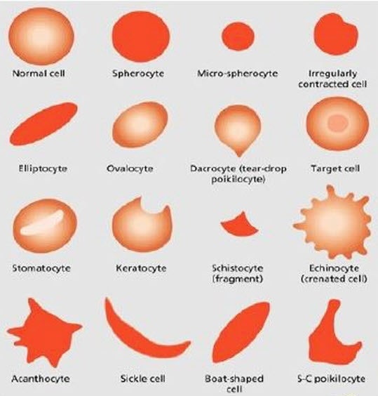적혈구(RBC)의 형태, 크기, 염색성, 봉입체 : 네이버 블로그