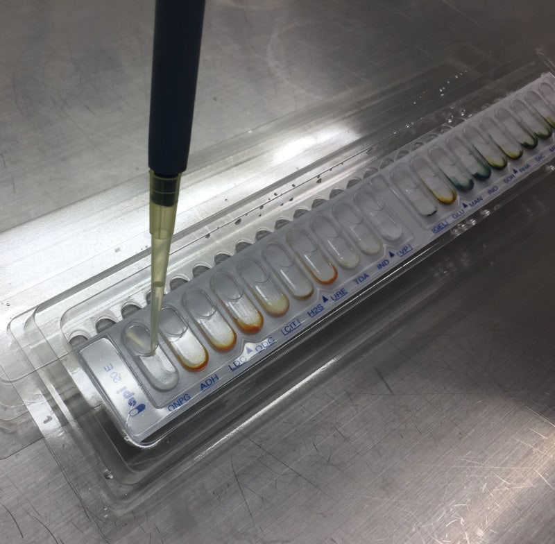 미생물 확인시험/생화학실험 API kit : 네이버 블로그