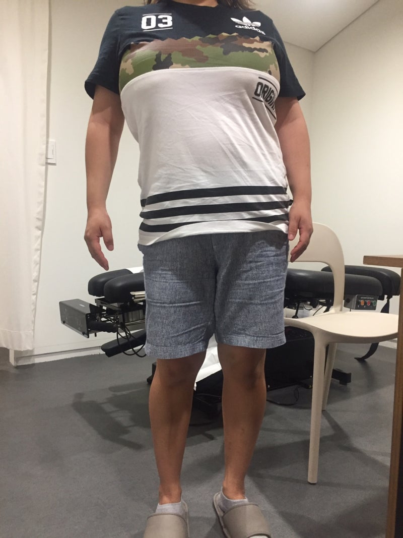 Antalgic posture, 통증회피자세 : 네이버 블로그