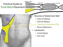 Transversus Abdominis plane block [초음파] : 네이버 블로그