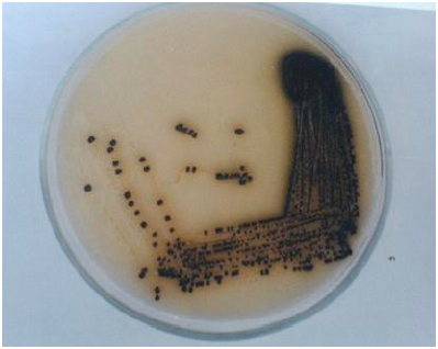 먹는물 품질관리 - 살모넬라(시험관법) : 네이버 블로그