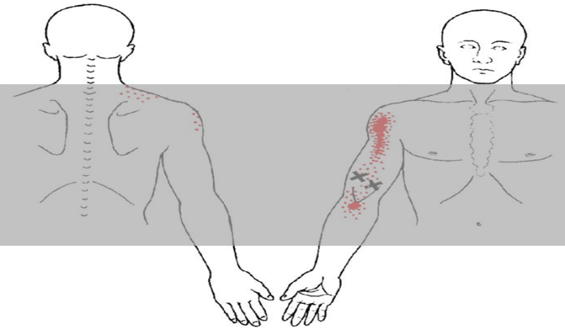 트레이너 발전소가 알려드리는 기능 해부학의 모든것 상완이두근위팔두갈래근 Biceps Brachii 네이버 블로그