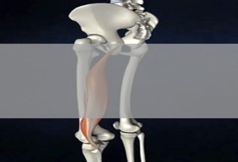 트레이너발전소가 알려드리는 기능 해부학의 모든것 대퇴 근막장근넙다리근막 긴장근 Tensor Fasciae Latae