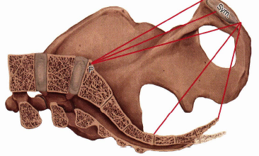 골반 구조 : 네이버 블로그