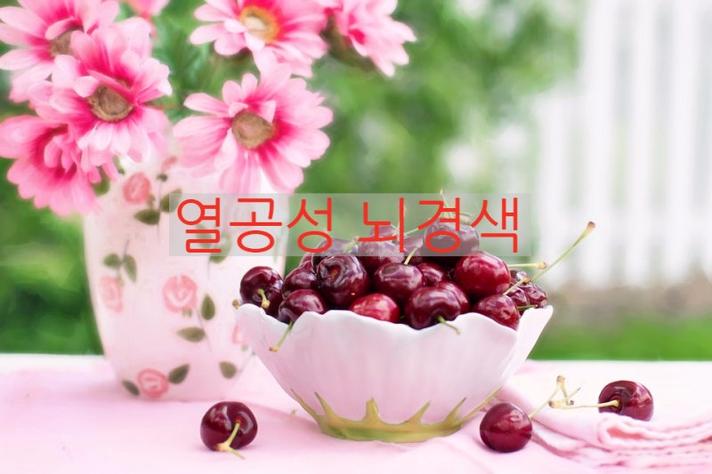 I63.9 상세불명 뇌경색(진구성,열공성) 진단금 필독 : 네이버 블로그