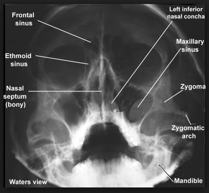 Waters view, PNS 엑스레이 : 네이버 블로그