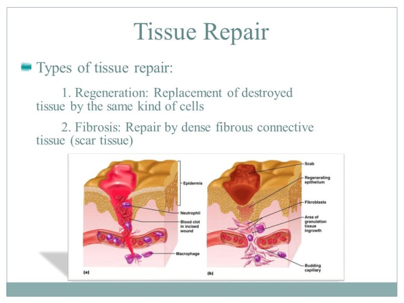 조직 수복 (tissue repair) : 네이버 블로그