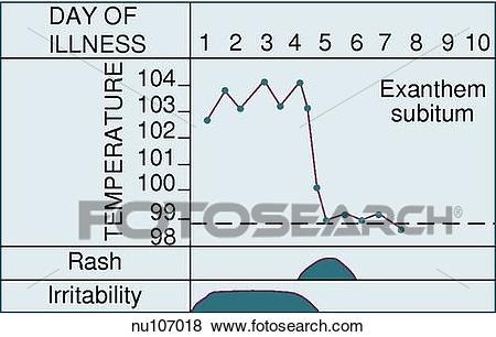 돌발진 (exanthem subitum) : 네이버 블로그