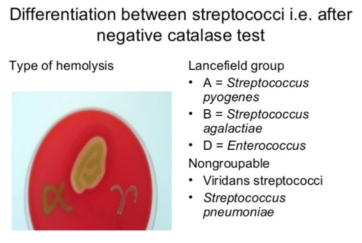 연쇄상구균의 분류, Differentiation between streptococci : 네이버 블로그