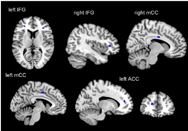 [우울증의 대표적인 사고]반추(rumination) : 네이버 블로그