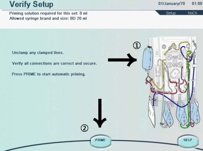 투석(dialysis) : 지속적 신대체요법의 모든것(CRRT)(정의, 원리, mode, 기본요소, 임상적용) : 네이버 블로그