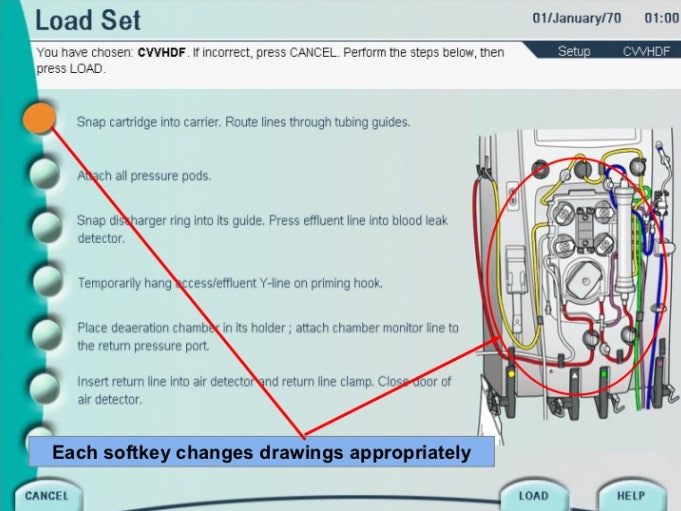 투석(dialysis) : 지속적 신대체요법의 모든것(CRRT)(정의, 원리, mode, 기본요소, 임상적용) : 네이버 블로그