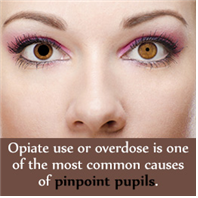 Pupil Reflex : 네이버 블로그