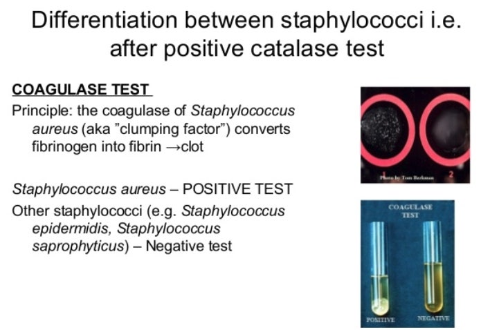 Staphylococcus Aureus Catalase Test