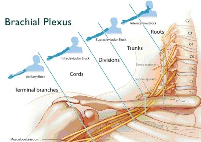 [어깨]Brachial plexus block 상완신경총 Supraclavicular BPB : 네이버 블로그