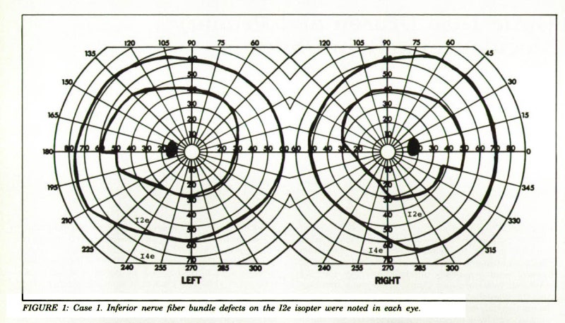 시야 ( Visual Field ) : 네이버 블로그