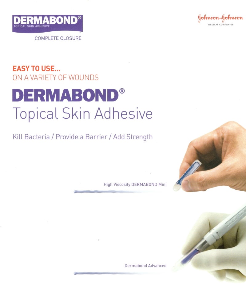 더마본드 , DERMABOND, 의료용피부접착제, : 네이버 블로그