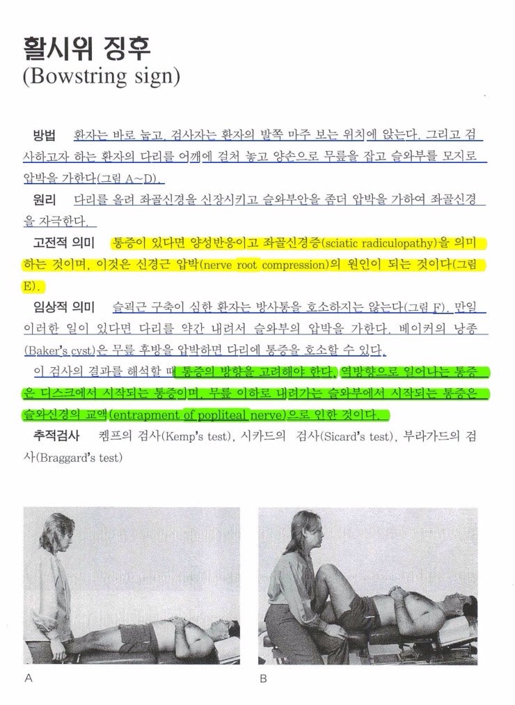 Bowstring sign : 네이버 블로그