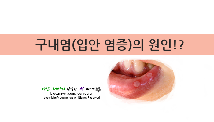 구내염 원인 입안 염증이 생기는 이유는 네이버 블로그