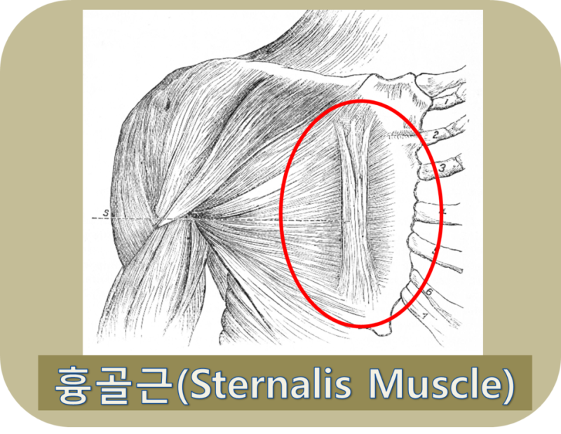 바른PT 김원장의 근육학 - 흉골근(Sternalis Muscle)-가슴답답함,흉통,화병,가슴통증,Round Shoulder ...