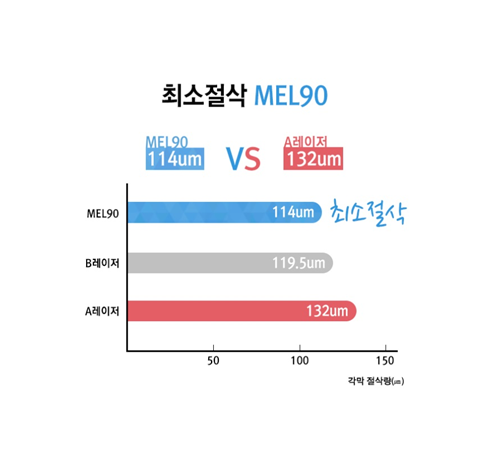 최소절삭 레이저 MEL90 라식 효과는? : 네이버 블로그
