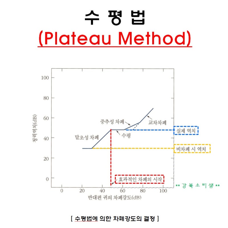 청력검사 방법 기도골도 청력검사 And 차폐 네이버 블로그