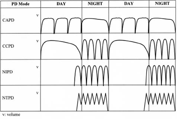 복막투석(Peritoneal Dialysis) : 네이버 블로그