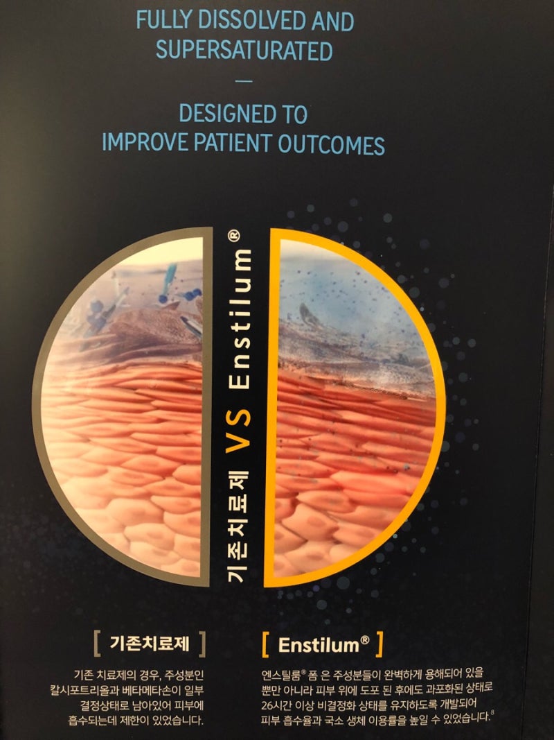엔스틸룸폼 (Enstilum foam) : 건선 국소 도포제의 끝판왕 : 네이버 블로그